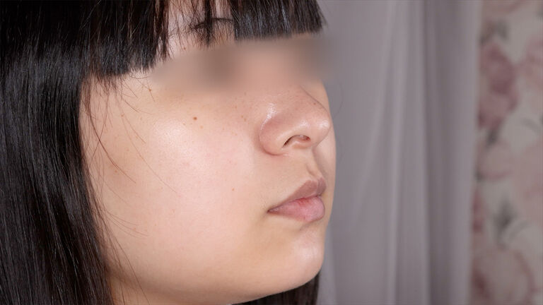 【鼻観察】 りんさんの鼻フェチ動画 えすとファンクラブ別館 (えすと(Est)) Product｜Fantia[ファンティア]